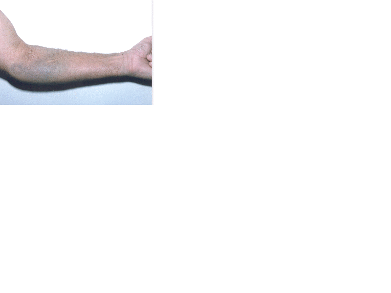 Brian Bush's Snakes Harmful & Harmless